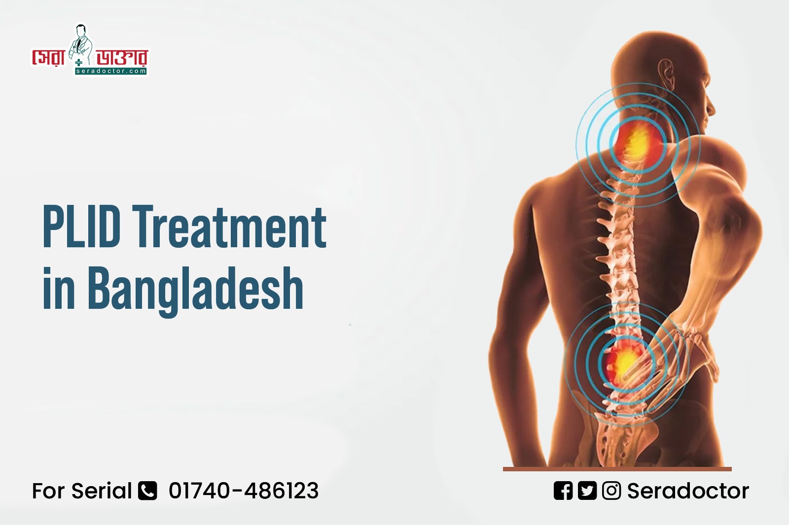 PLID Treatment in Bangladesh: Causes, Symptoms, Diagnosis, and Best ...