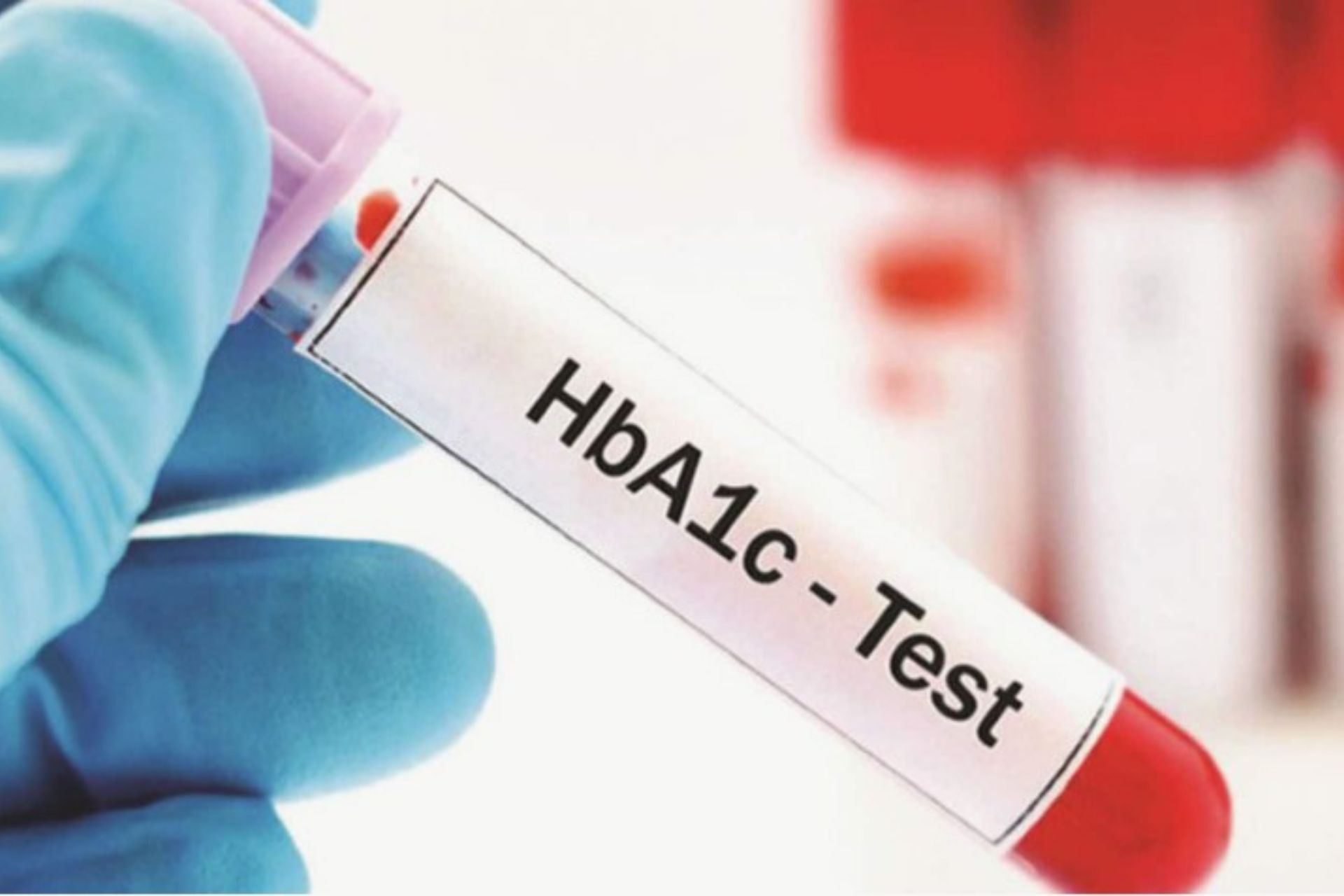 Hba1c test price in Bangladesh.